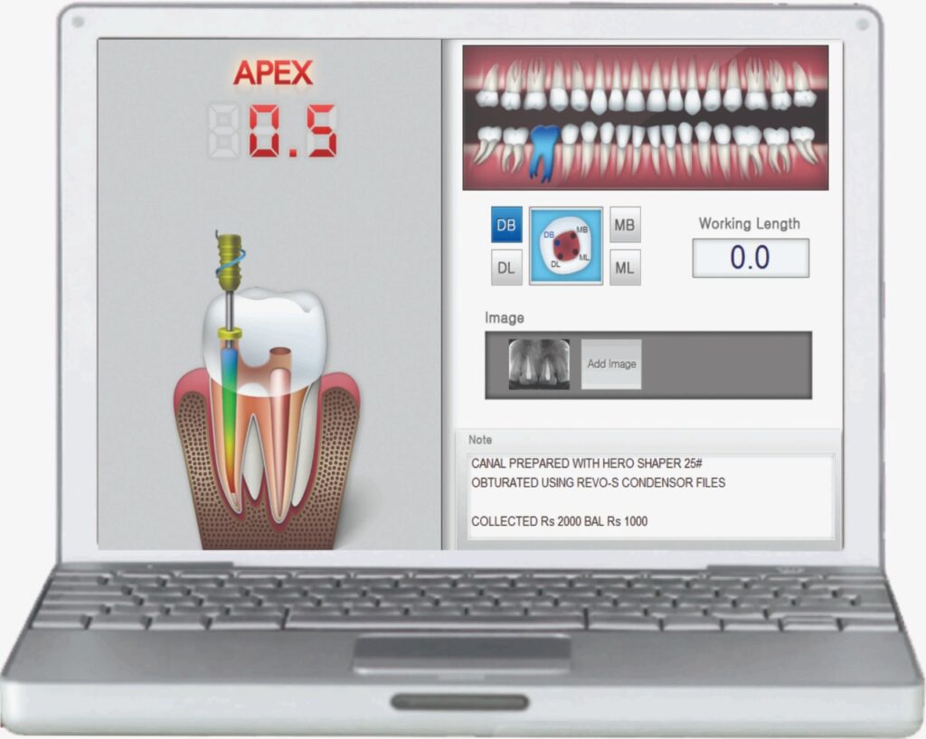laser dentist in Mumbai, best dentist in Mumbai Kurla - Smile4U